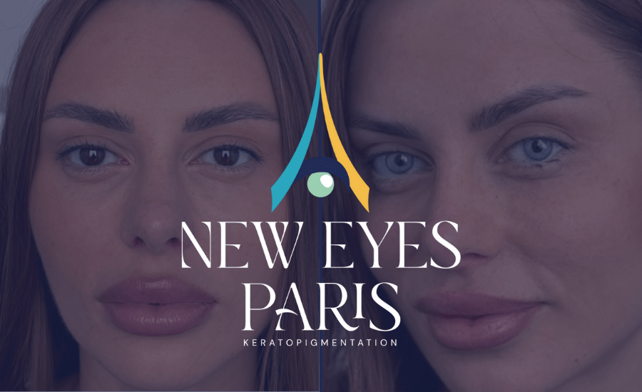 Kératopigmentation FLAAK - Changer la couleur des yeux